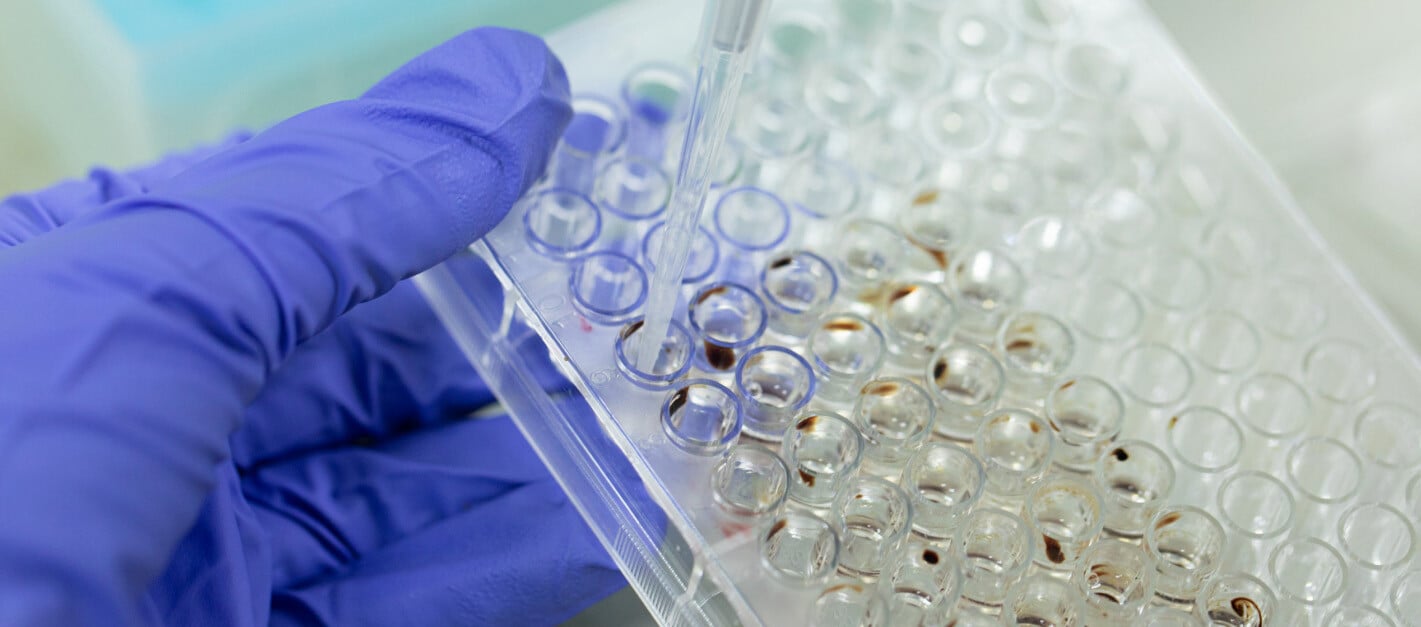 Olink Target platform