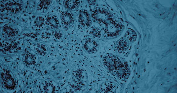 10x Single Cell Sequencing